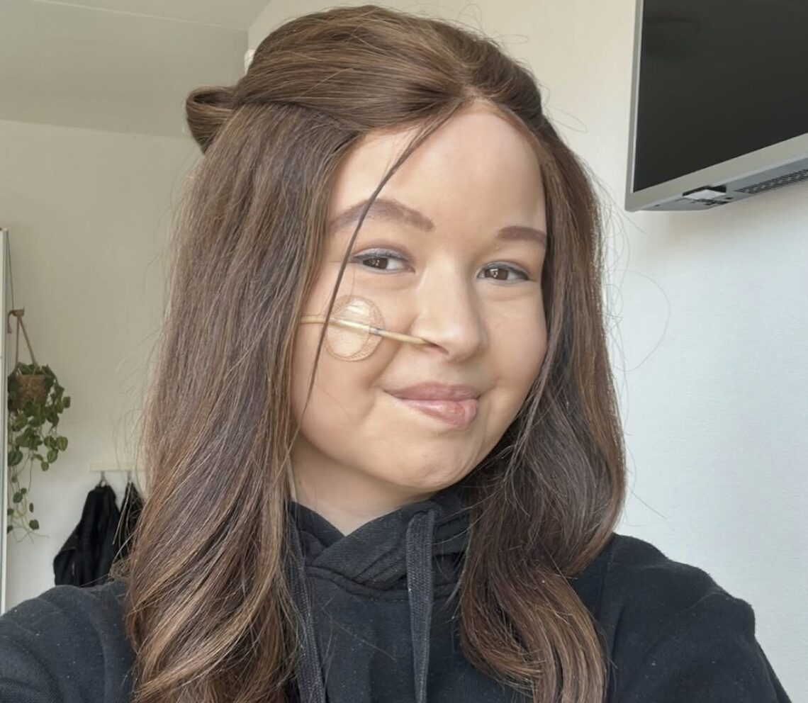Update: Jade Kops (18) gestopt met behandeling. “Ik ben kapot” – Info ...